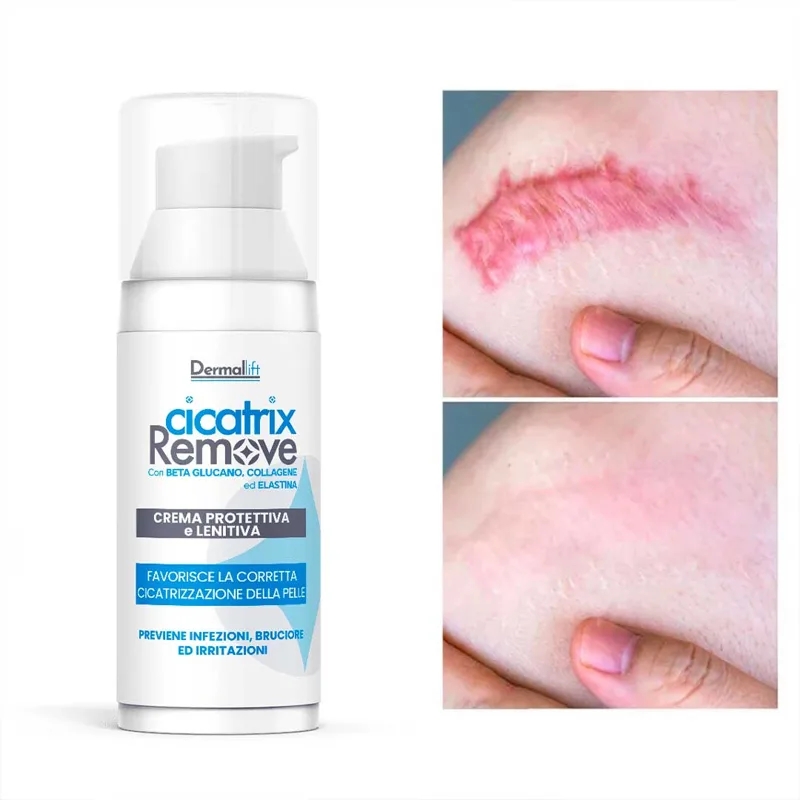 Cicatrix Remove Crema Protettiva e Lenitiva: La soluzione per una ...